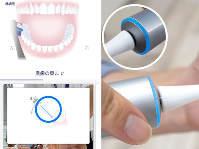 歯周病知らず!パナソニックドルツEW-DT72は正しい歯の磨き方 歯周病知らず!パナソニックドルツEW-DT72は正しい歯の磨き方